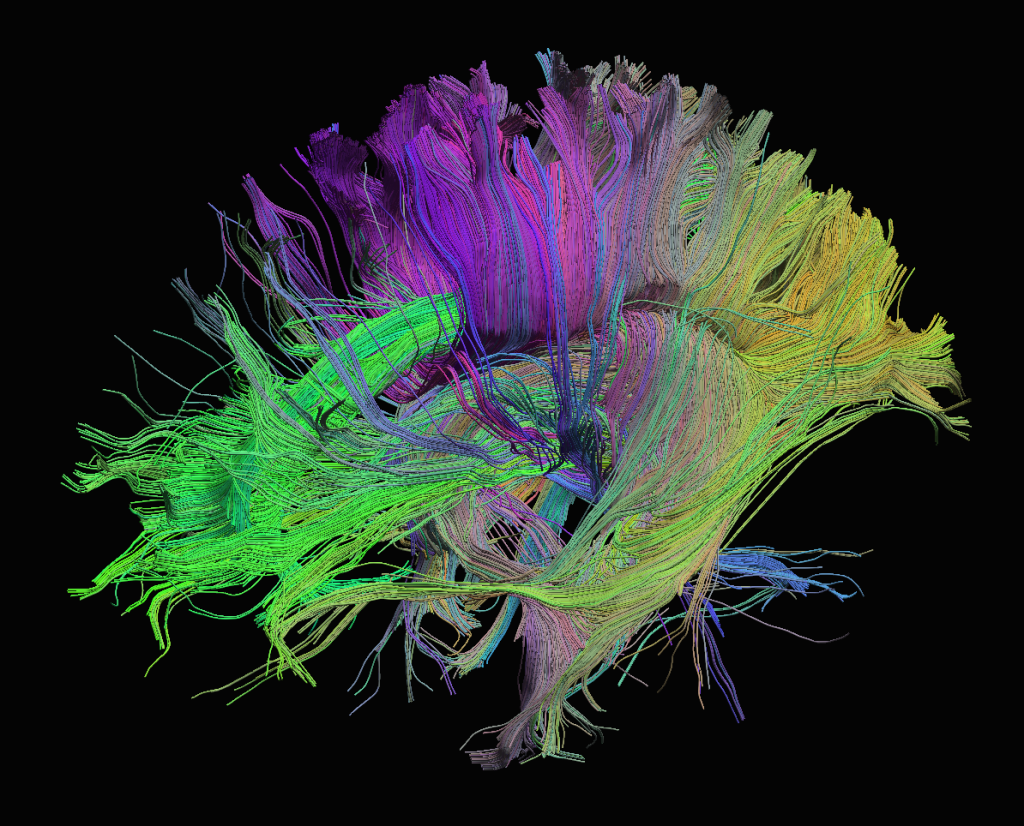 Tractography Visualization · BrainSuite