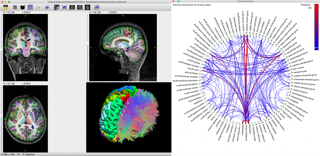BrainSuite Interface · BrainSuite