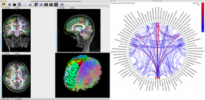 BrainSuite Interface · BrainSuite