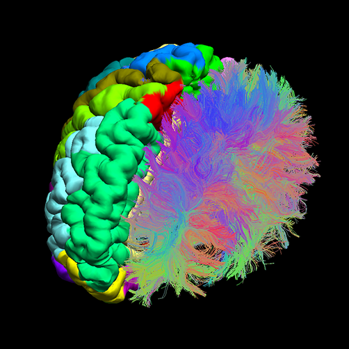 BrainSuite21a Released · BrainSuite