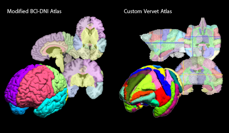 Creating Custom Atlases · BrainSuite