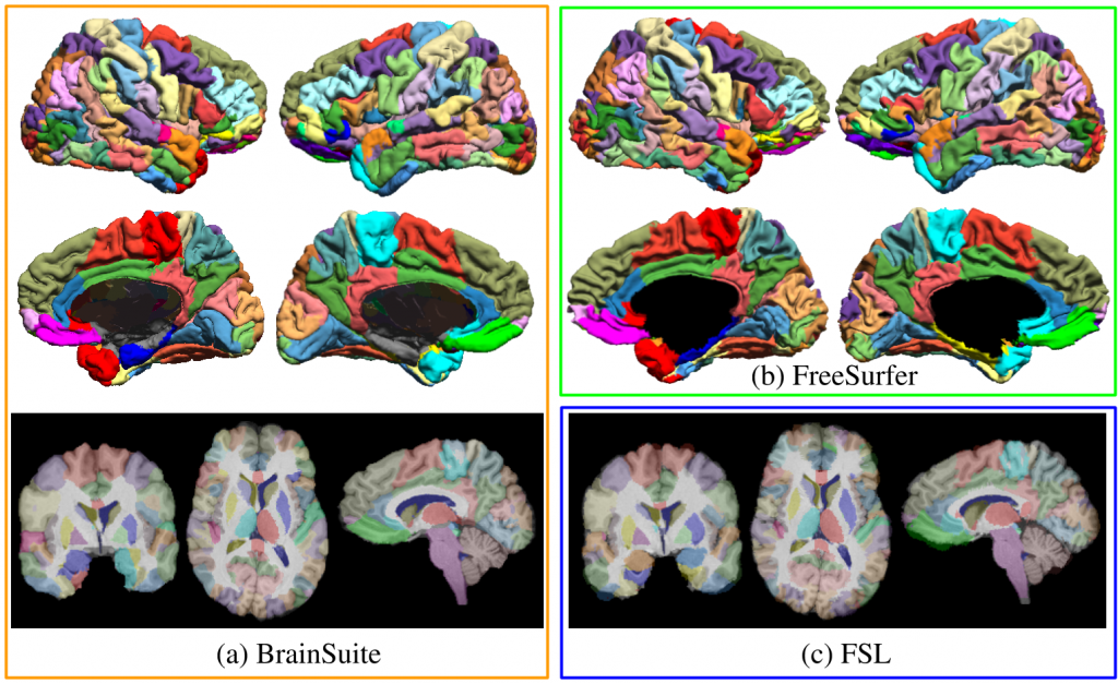 Using the USCBrain Atlas with BrainSuite and Other Software Packages ...