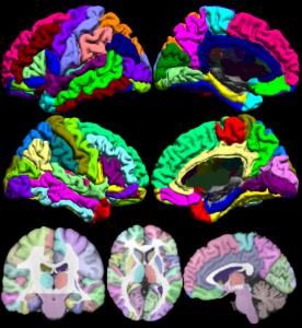 BrainSuite Atlases · BrainSuite