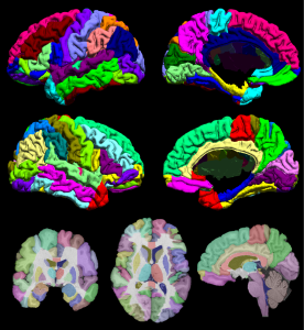 BrainSuite Atlases · BrainSuite