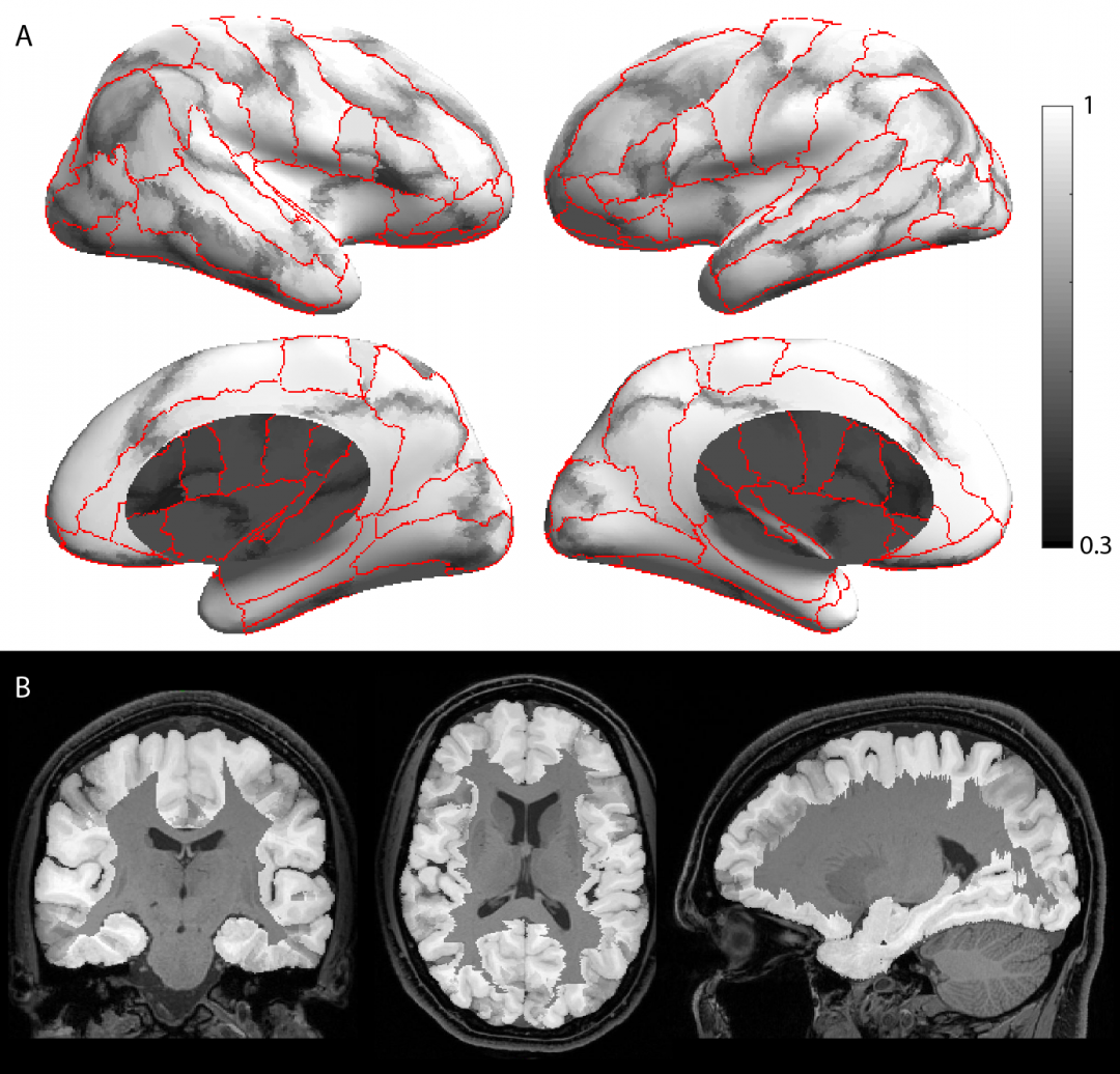 USCBrain Atlas · BrainSuite